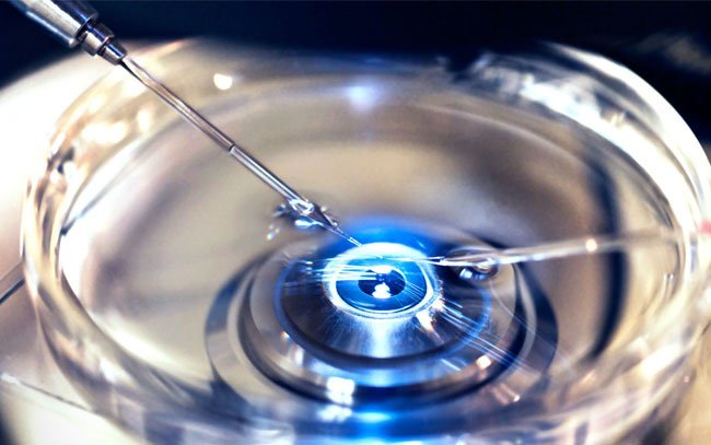 Hace 40 años, nació el primer bebé probeta